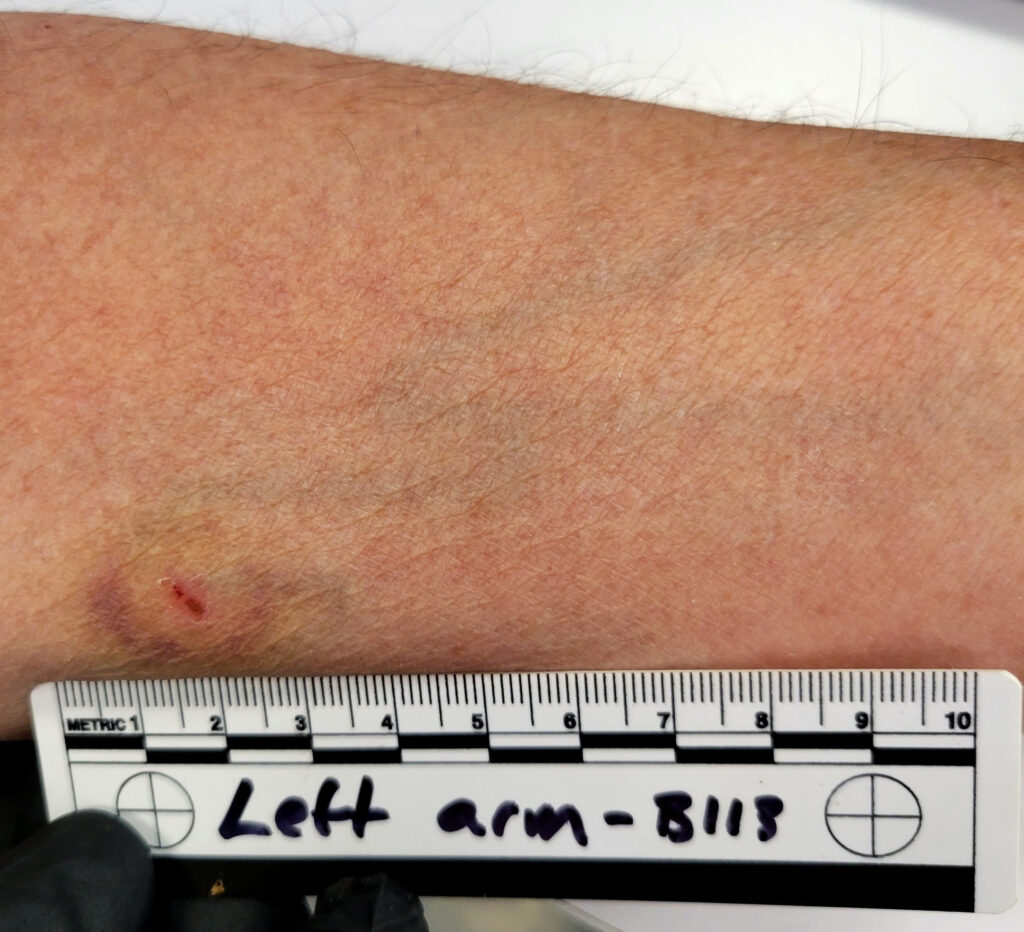 Photomacrographic Scale