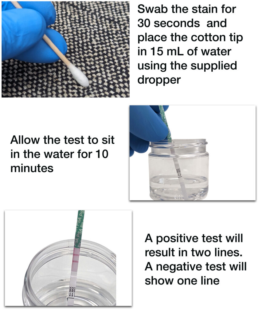 Semen Detection Test: Quick and Accurate Results